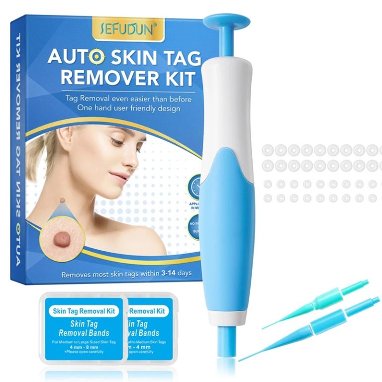 Skin Tag & Wart Removal - Eliminate Acrochordon On Skin Eyelid Neck ...